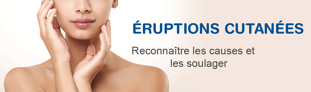 Eruptions cutanées : conseils de notre pharmacien | Farmaline