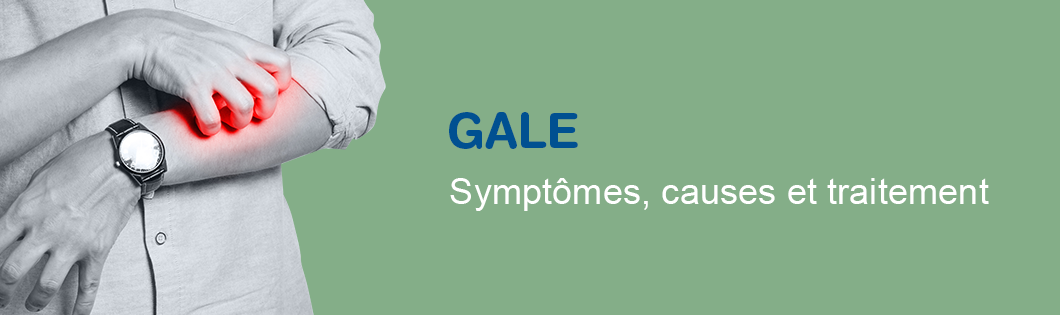 Gale : conseils de notre pharmacien | Farmaline