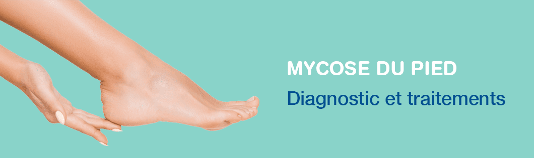 Mycose du pied - Conseils de notre pharmacien | Farmaline